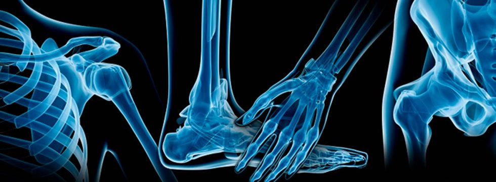 ¿Qué Estudia la Ortopedia? - Dr. Esteban Castro - Médico Traumatólogo ...