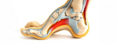 Pies Torcidos Archivos - Dr. Esteban Castro - Médico Traumatólogo ...